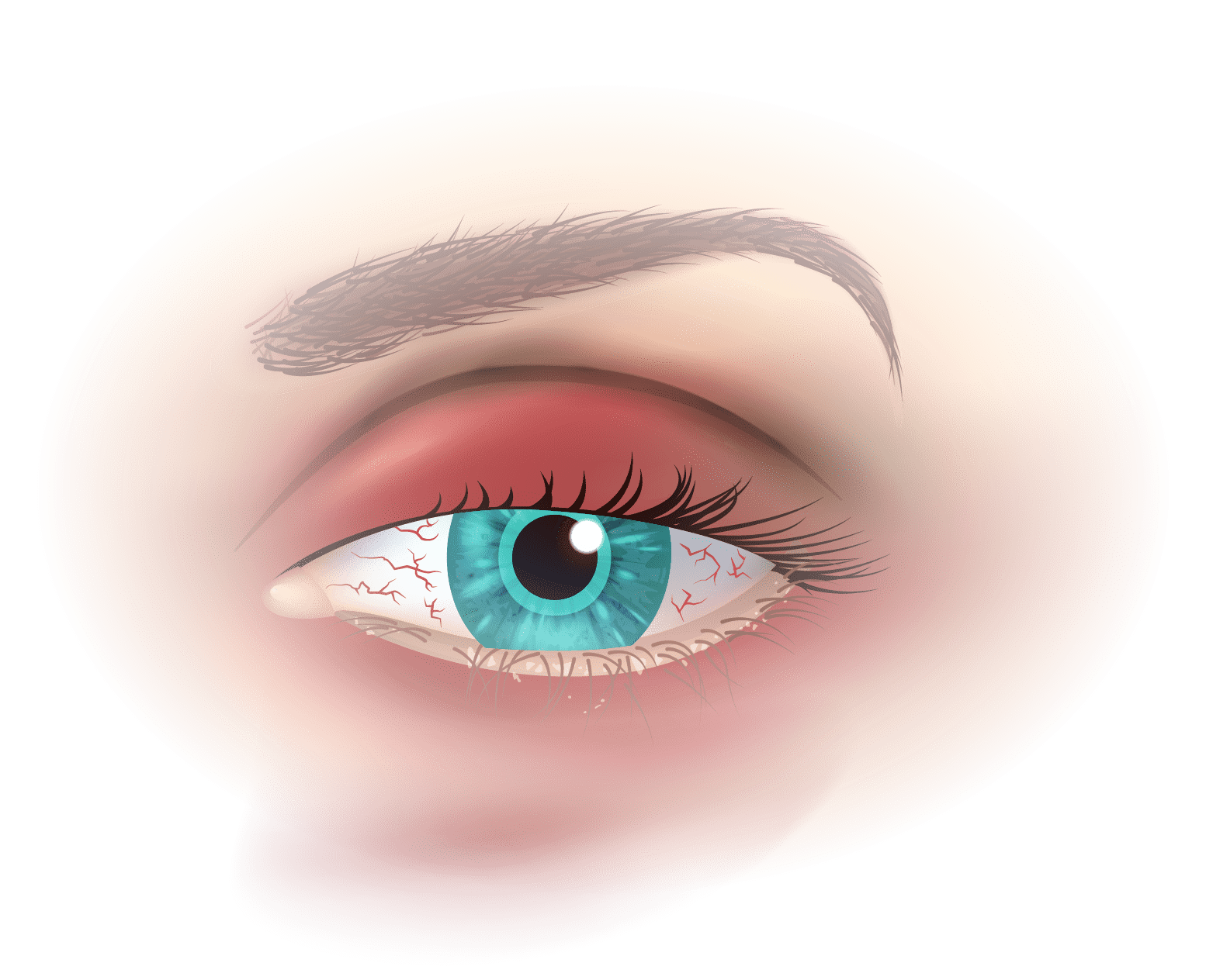 Diagnostic - Diagnostiquez et traitez votre sécheresse oculaire